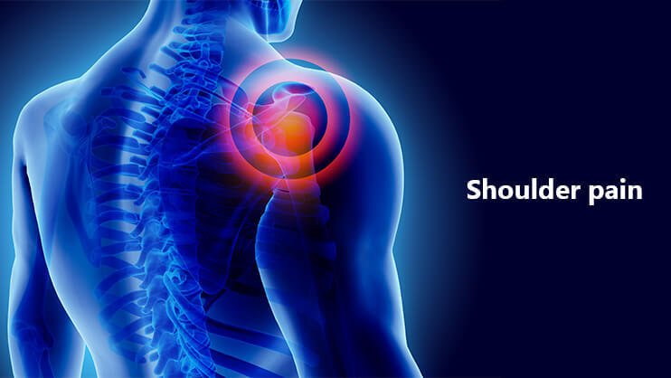 What is Shoulder Arthritis? Symptoms,Causes,Diagnosis,Treatment